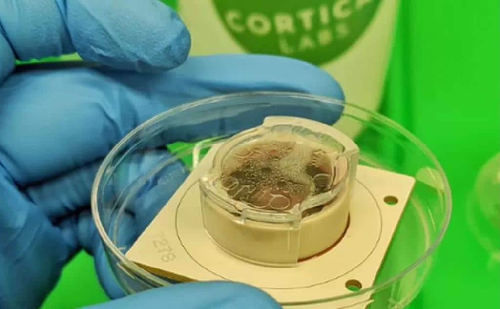 Researchers Create DishBrain, an AI Made With Human and Mice Brain Cells